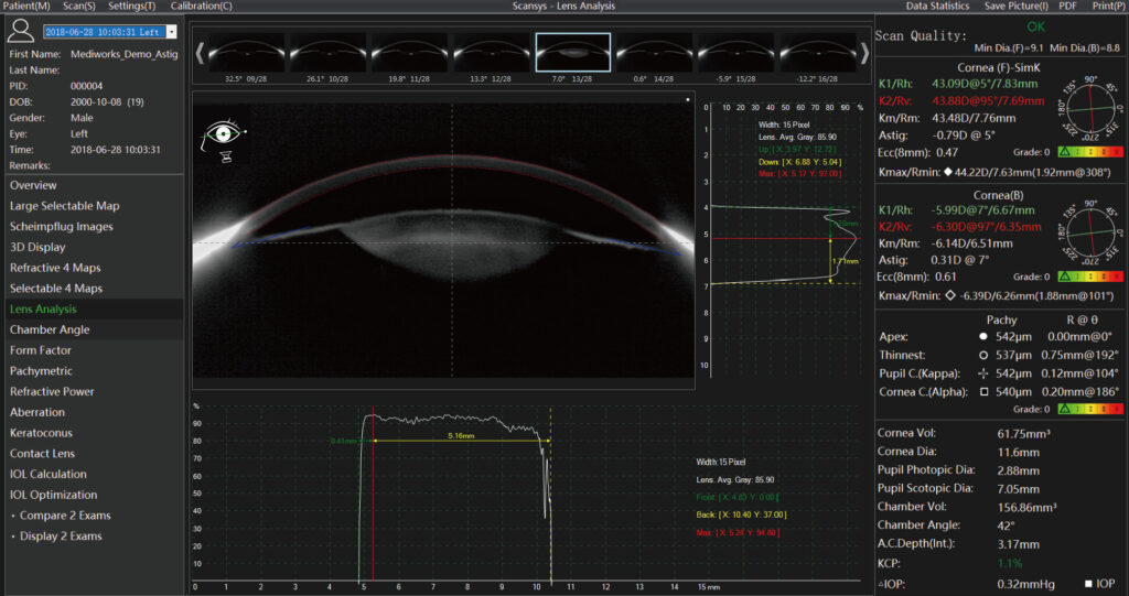 Anterior Segment Analyzer Scansys TA 517 | Lab Medica