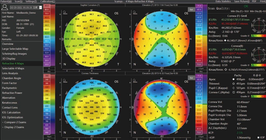 Anterior Segment Analyzer Scansys TA 517 | Lab Medica